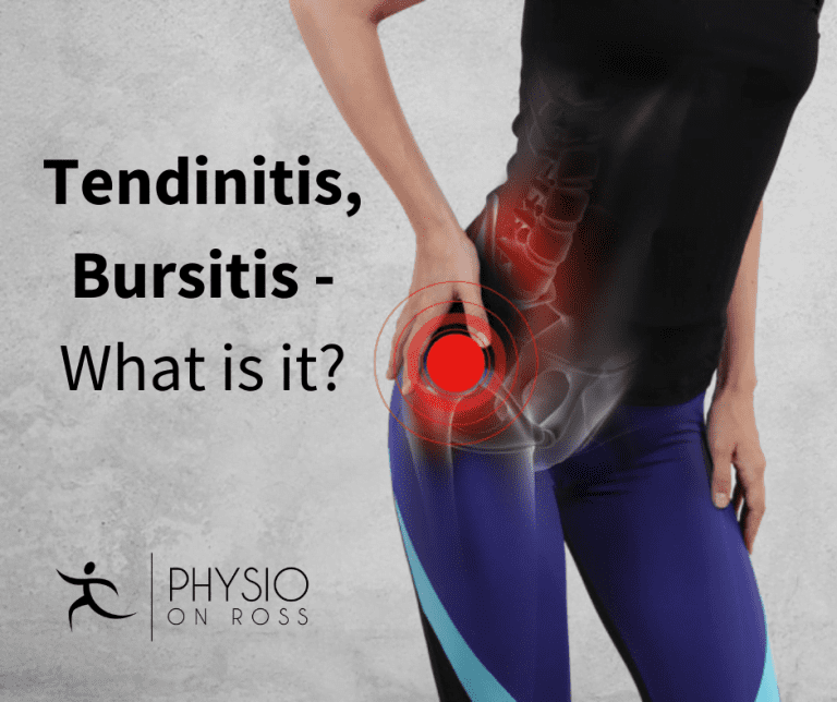TENDINITIS, BURSITIS - What is it? | Physio On Ross Townsville